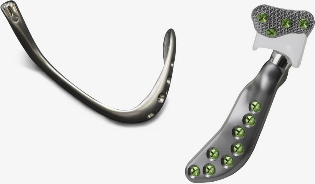 TMJ Concepts | Stryker