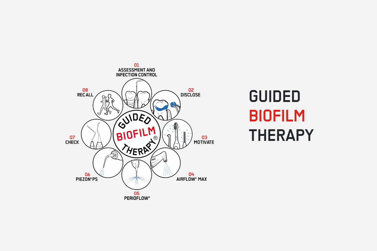 Guided Biofilm Therapy Rochester, NY | ROC Perio & Implants