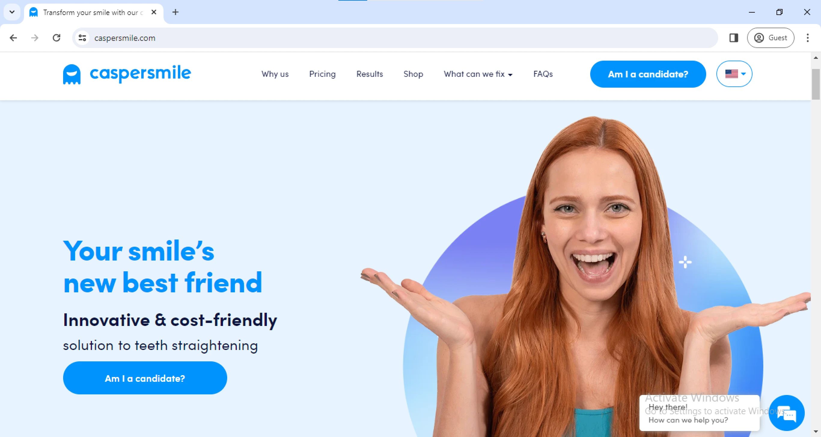 Caspersmile Clear Aligners Review