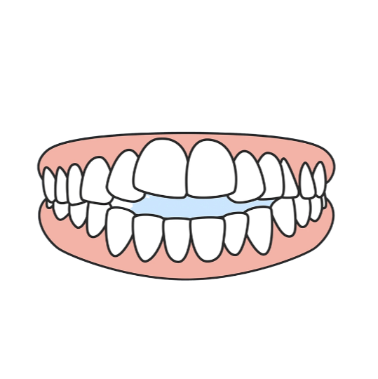 3 Distinct Paths to Achieve Straight Teeth with Clear Aligners