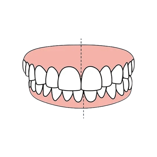 StraightMyTeeth: Your Guide to Teeth Straightening