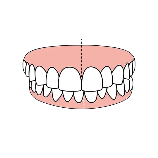 StraightMyTeeth: Your Guide to Teeth Straightening
