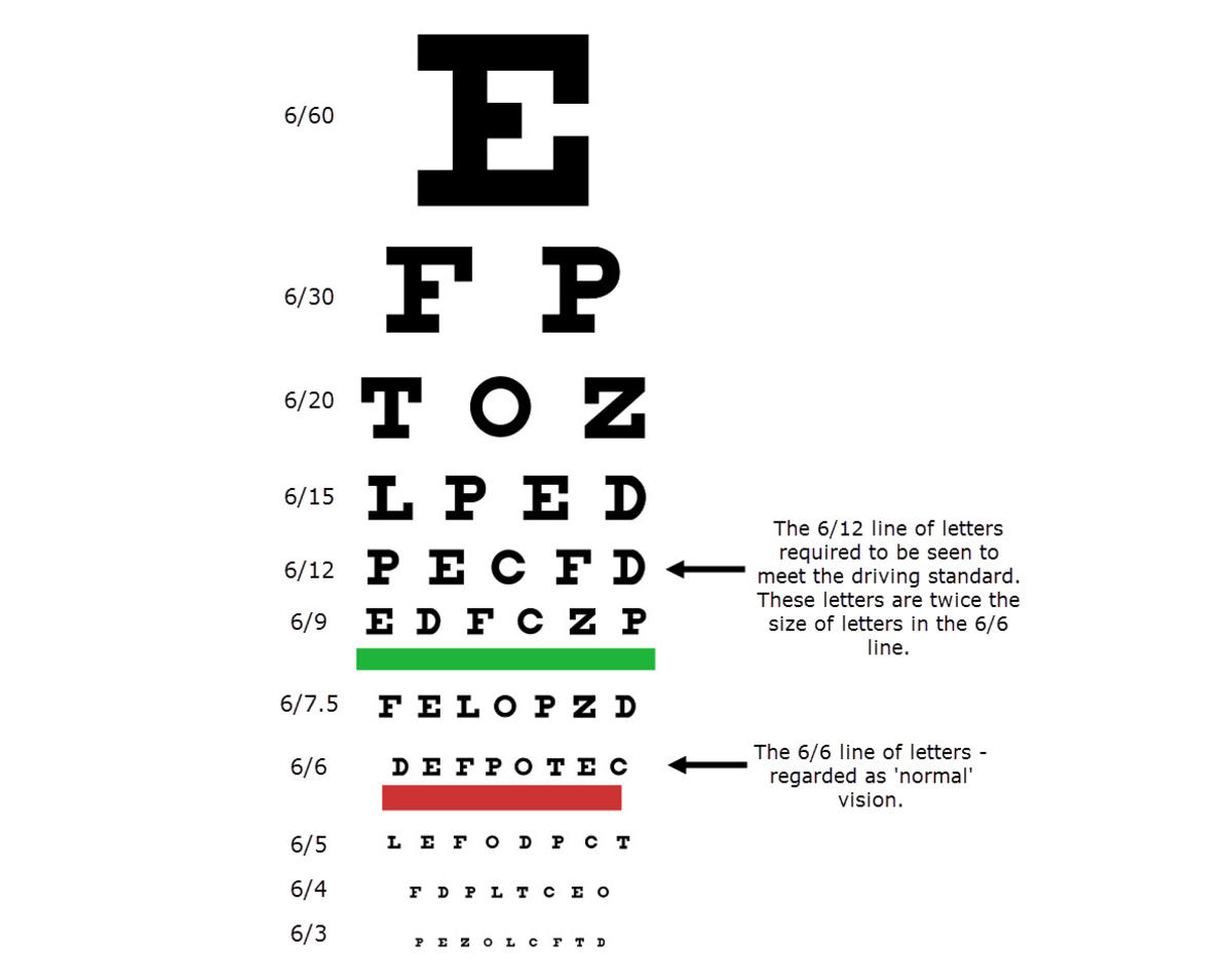 Vision and Driving Safety Assessments | Innovative Eye Care