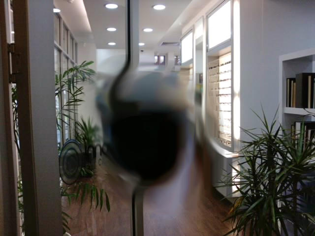 Macular Degeneration Diagnosis and Treatment | Innovative Eye Care