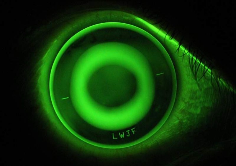 Night Lenses (OrthoK) | Innovative Eye Care