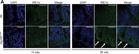 Tissue-Specific Knockout Mouse | How to focus on one tissue | genOway