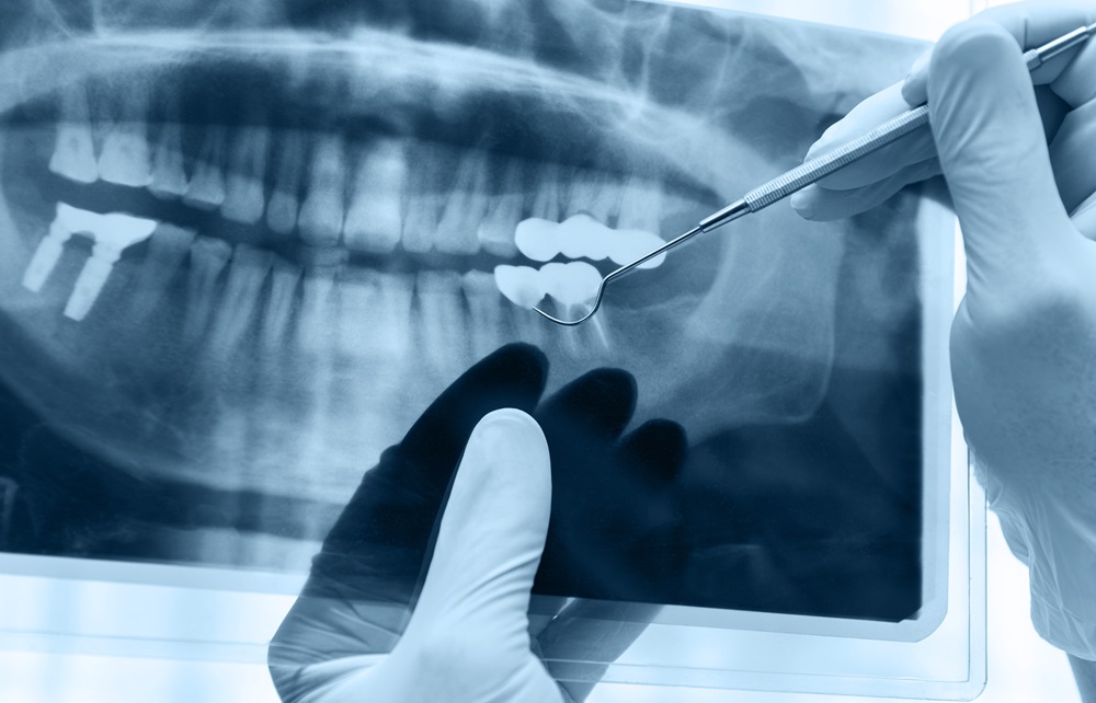 Family Dentistry in Bulverde | Pieper Smiles
