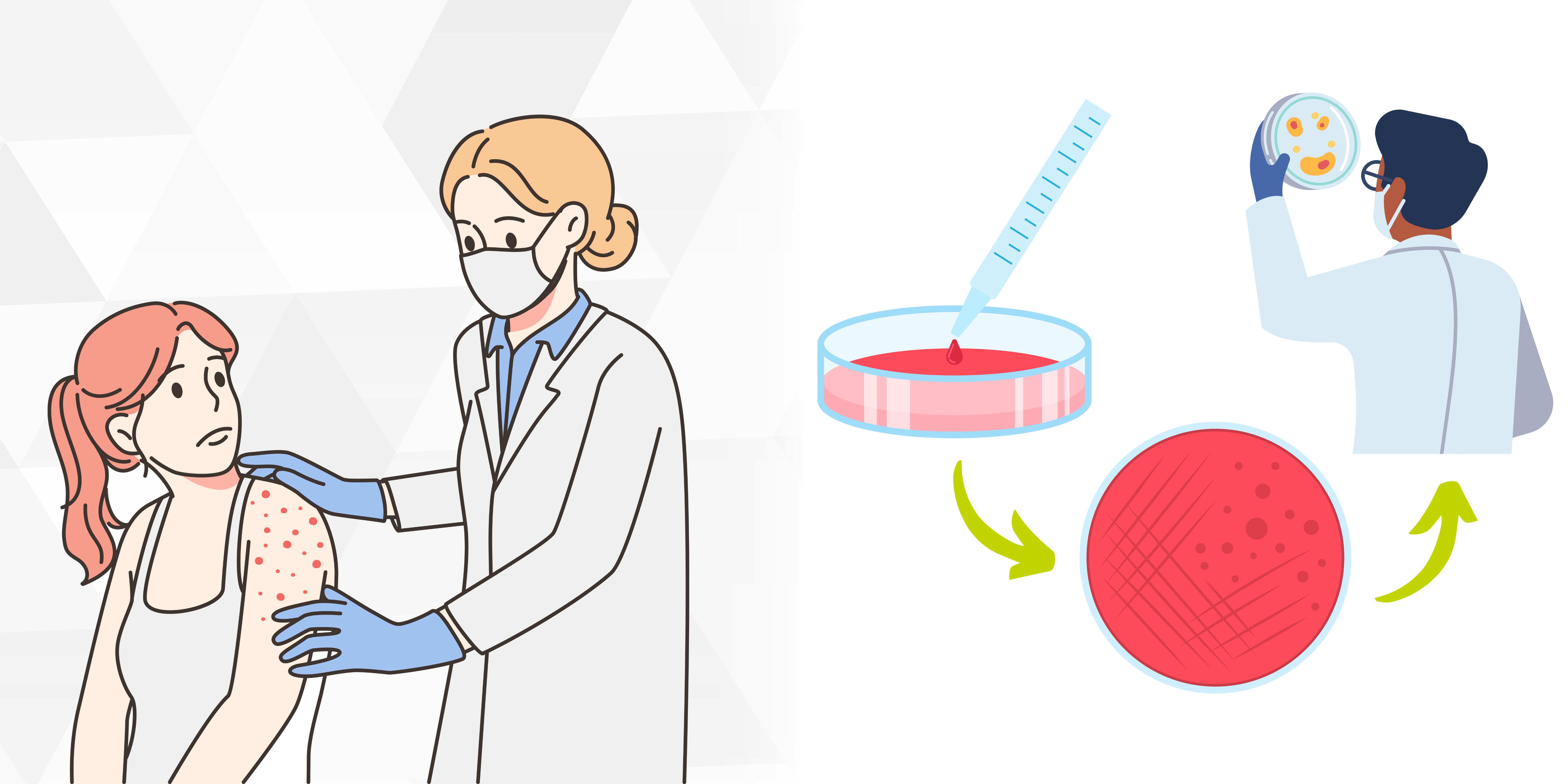 Biohubx | Four Assays for the Testing of Skin Sensitizing Materials