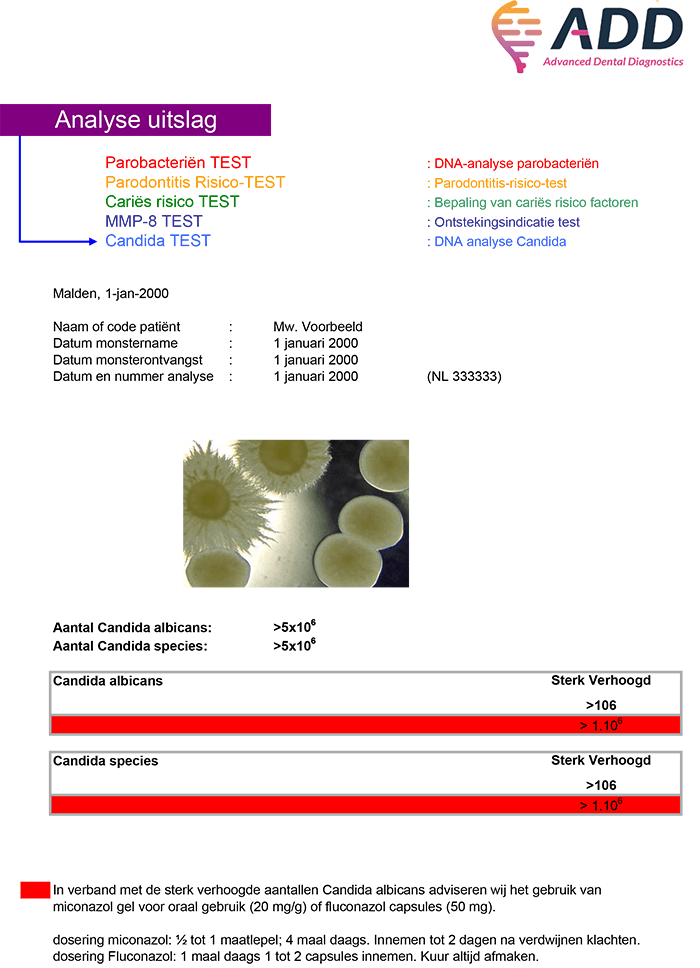 Controleer Candida in de mond van uw patiënt | ADD Laboral