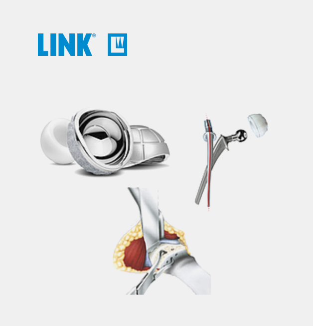 Total Joint Reconstruction - Texas Orthopaedic Advancements - Global ...