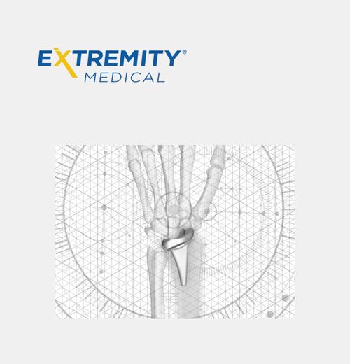 Extremity Reconstruction - Texas Orthopaedic Advancements - Global ...
