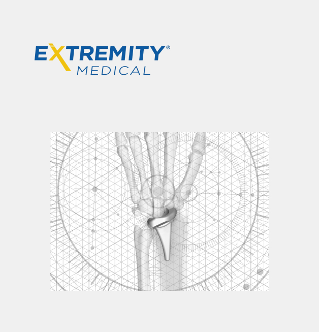 Extremity Reconstruction - Texas Orthopaedic Advancements - Global ...