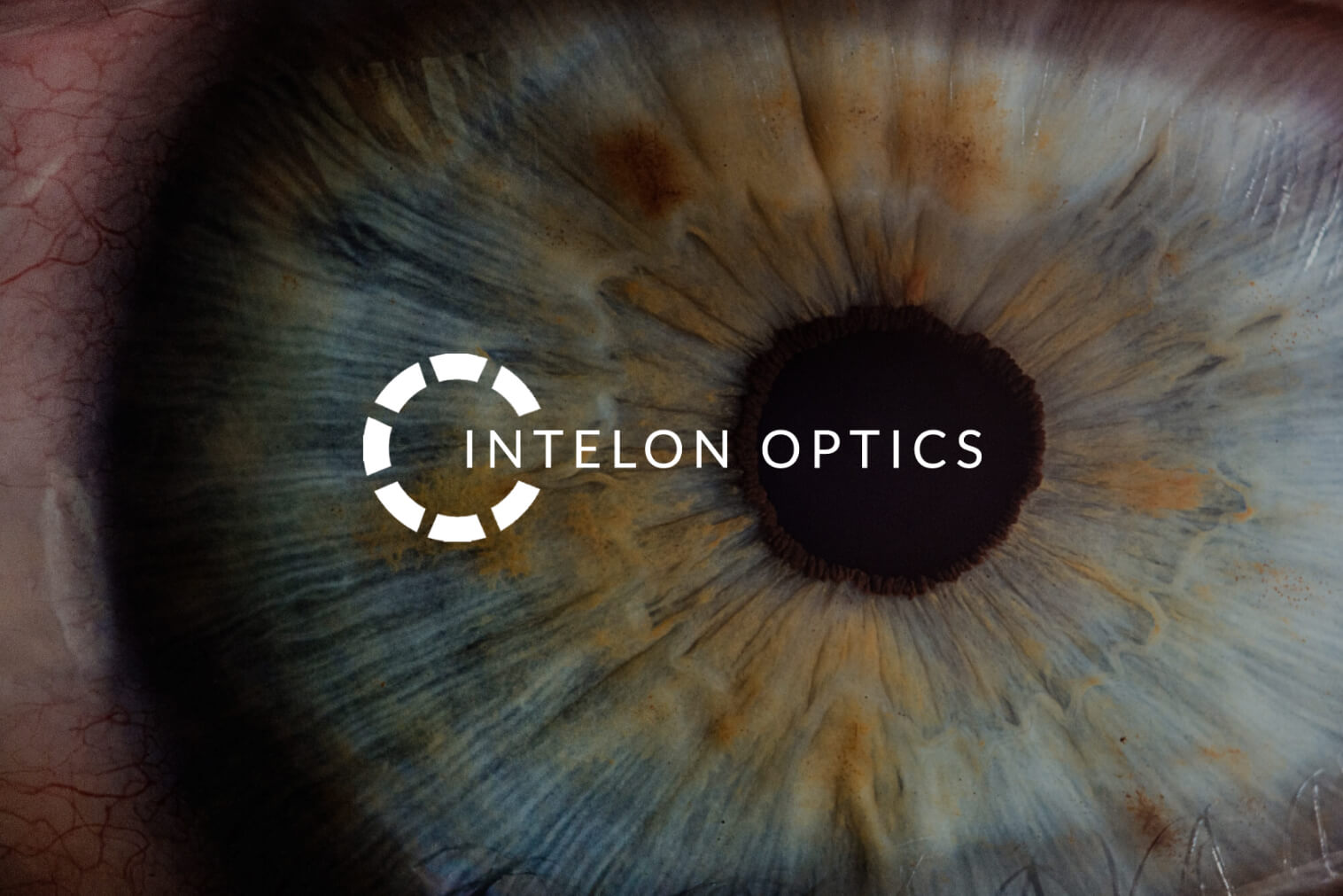 Enabling transformative eye diagnostics