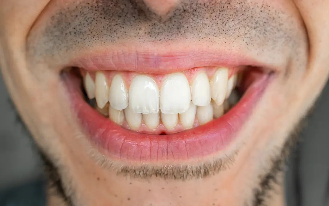 Dentist in Lake Ridge | Lake Ridge Dental