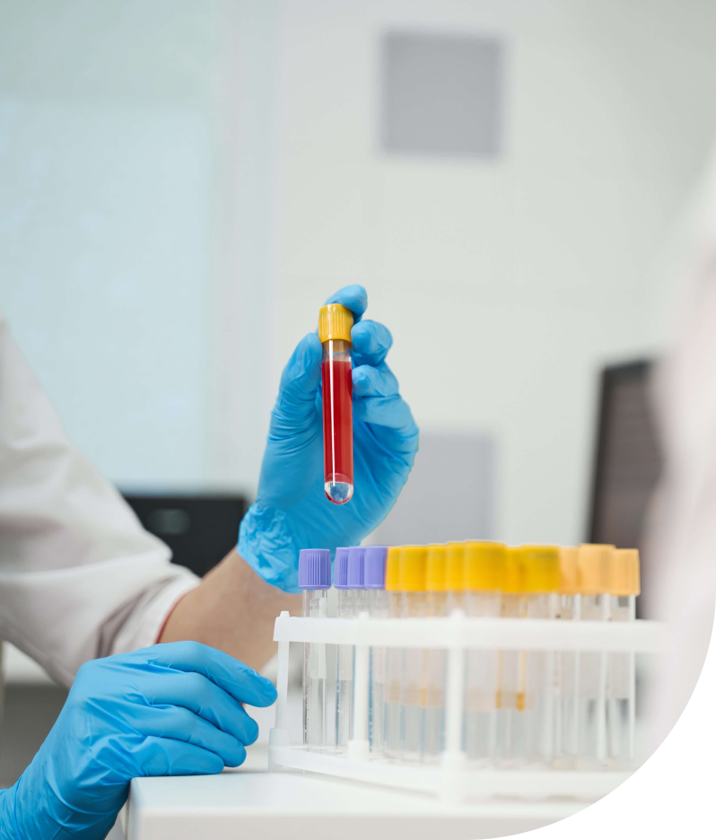 ACTMonitor® Lung | ACT Genomics