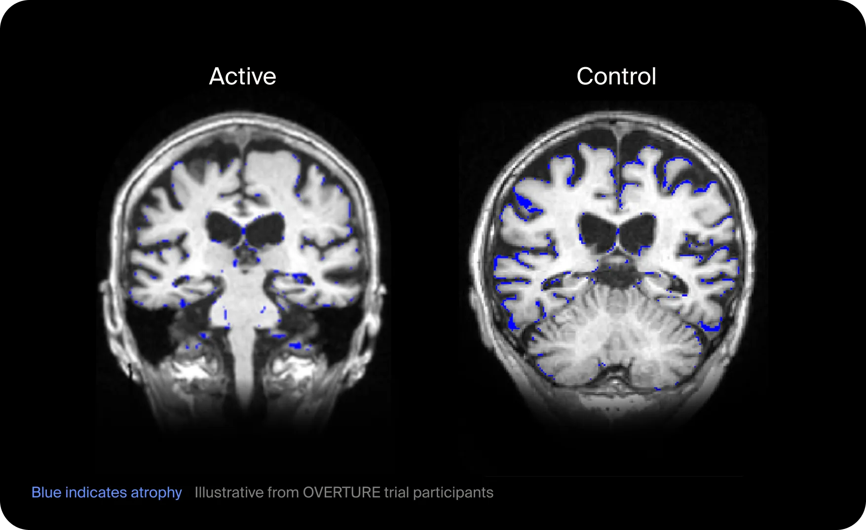 Science | Cognito Therapeutics