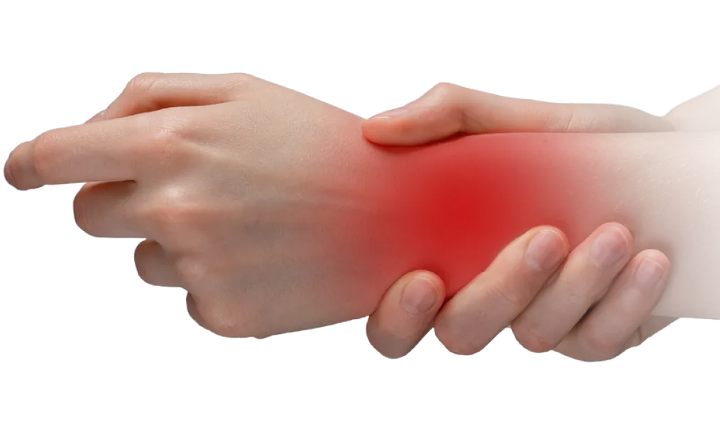 The Ovation Technique - Carpal Tunnel Relief | Ovation Hand Institute