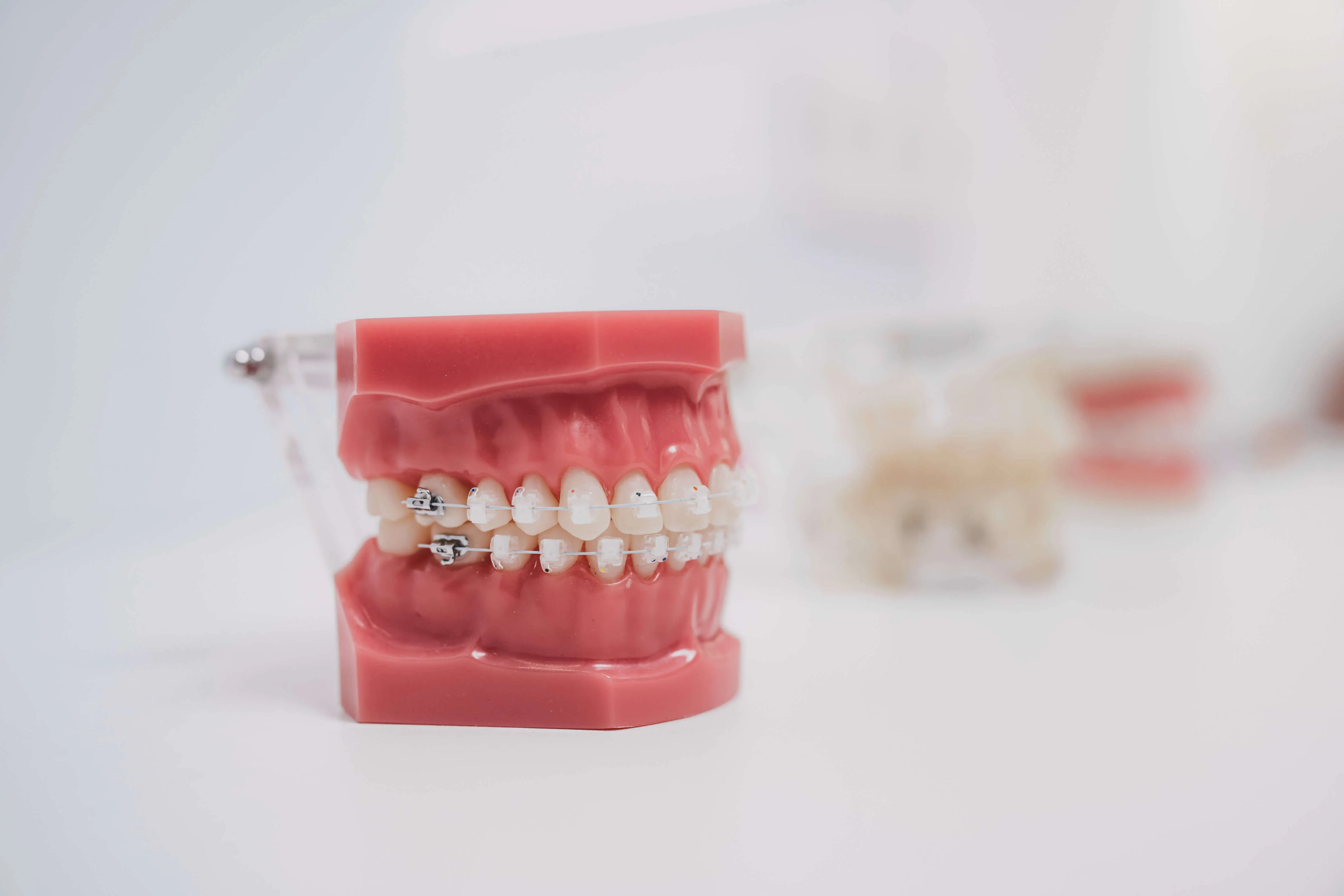 Kontakt | Implanty | Ortodoncja | Stomatolog Warszawa | Smile Factory