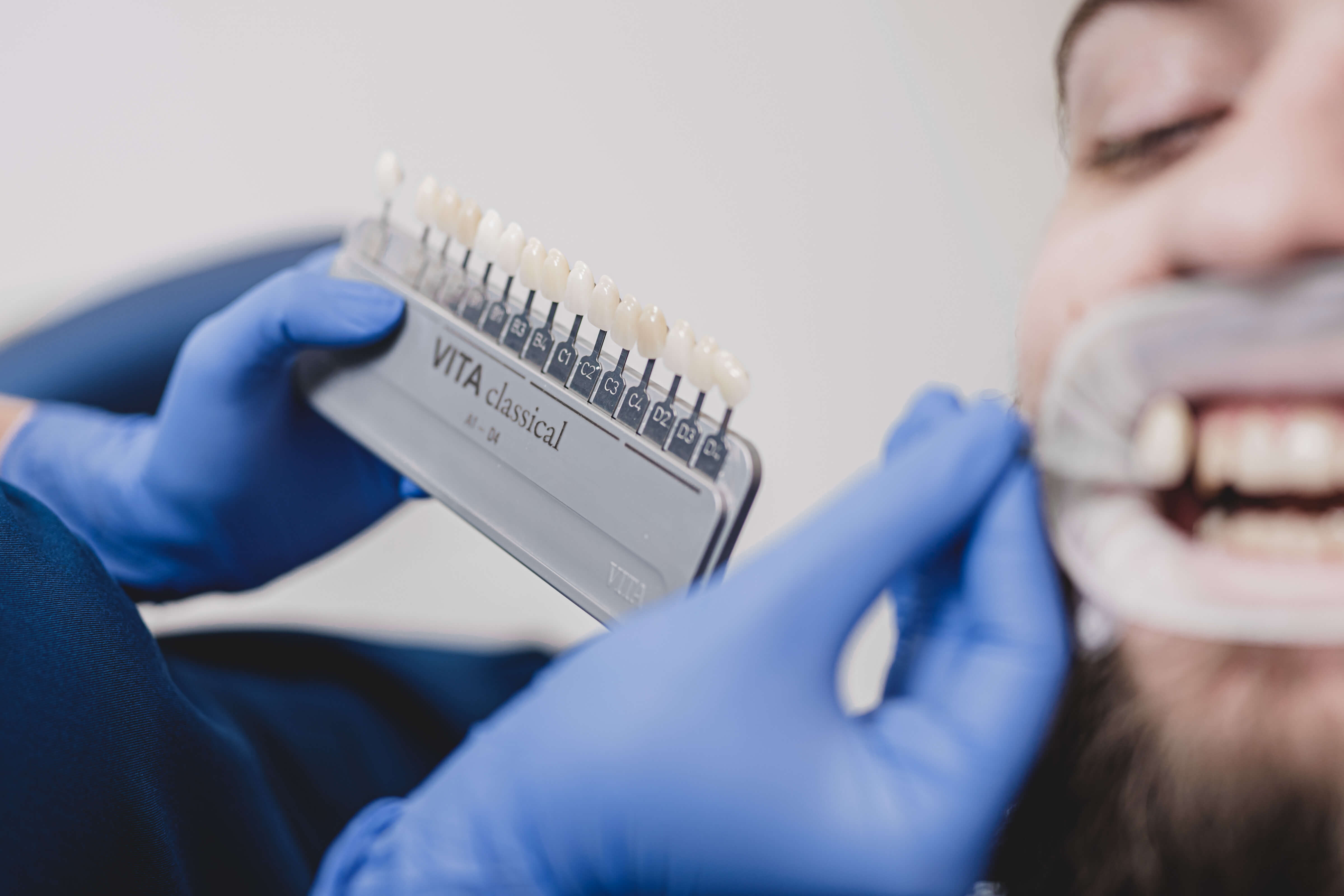 Licówki | Implanty | Ortodoncja | Stomatolog Warszawa | Smile Factory