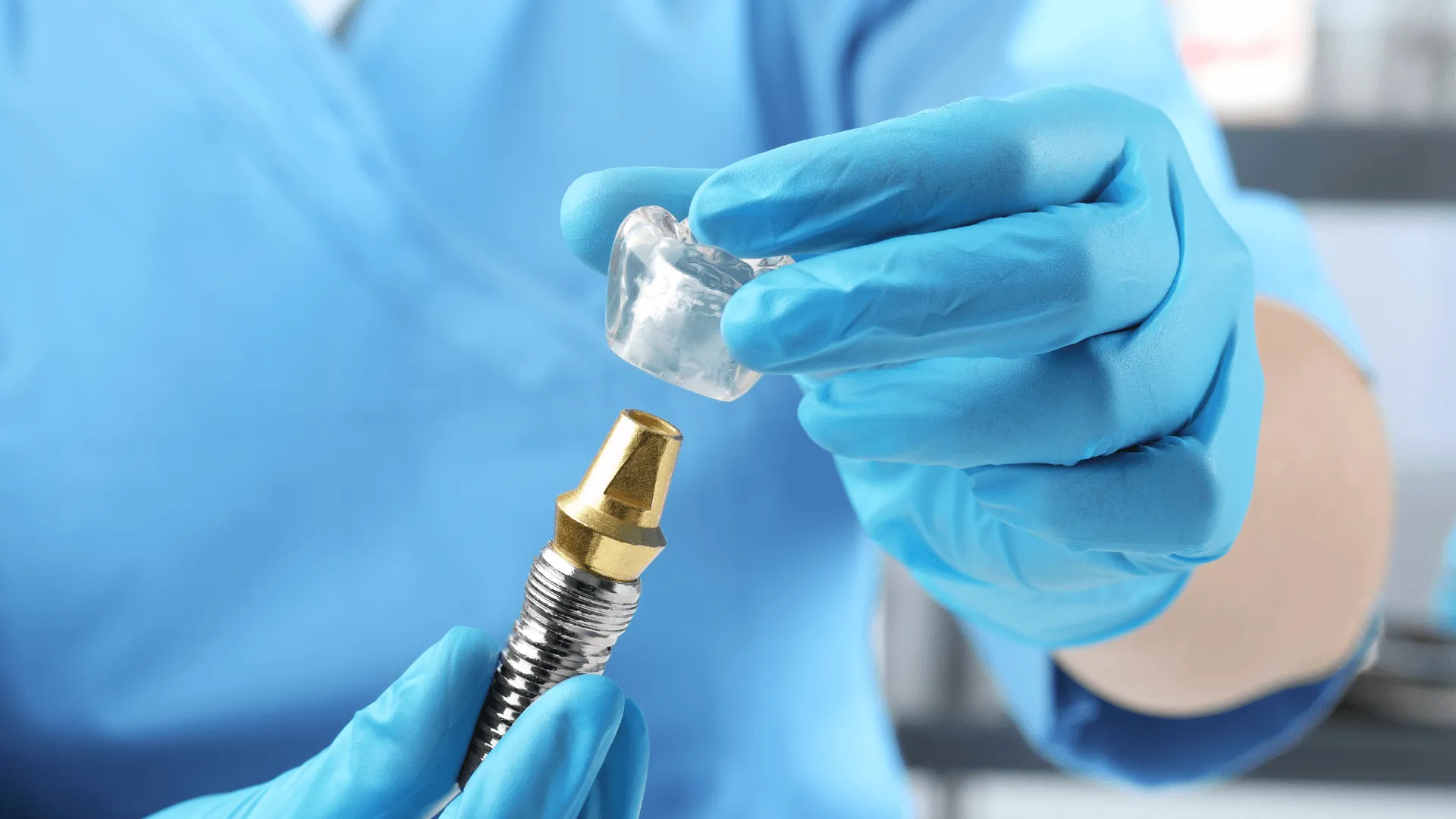 Smile Factory | Implanty | Ortodoncja | Stomatolog Warszawa