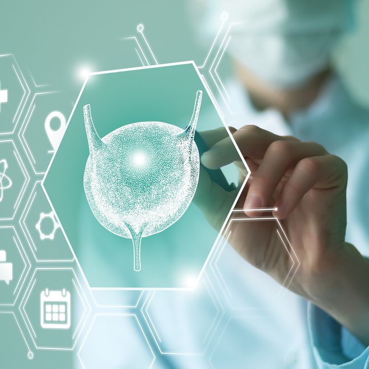 What Are Bladder Polyps?