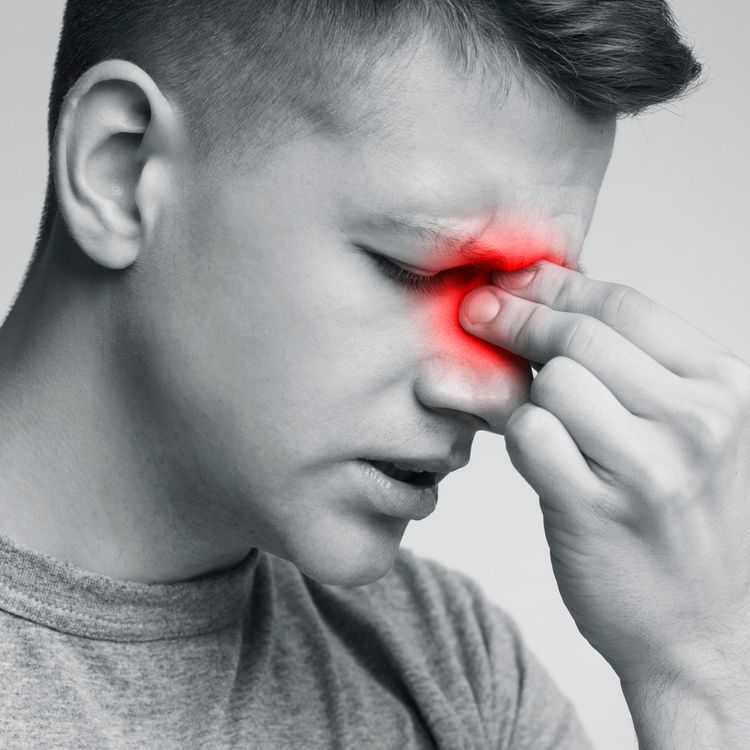 Understanding Sinusitis Headaches: Causes, Symptoms, and Treatment