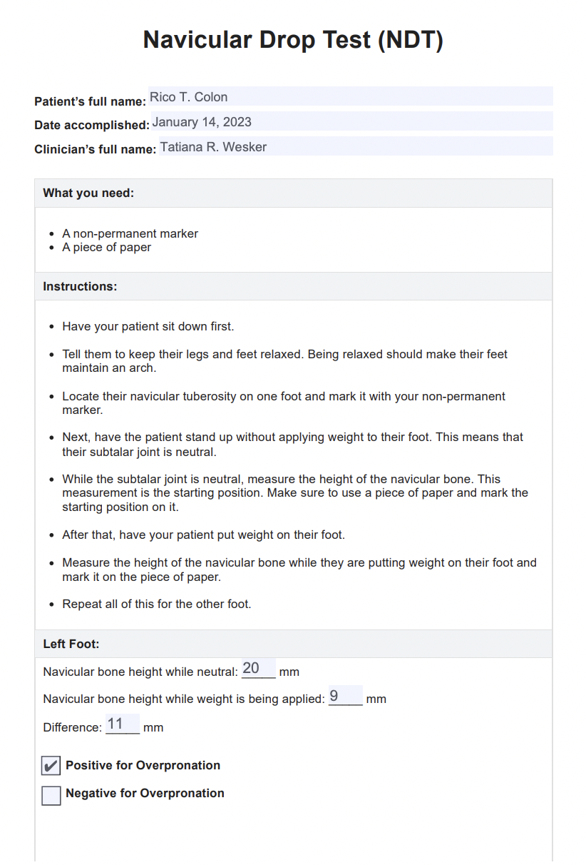 Navicular Drop Test (NDT) & Example | Free PDF Download