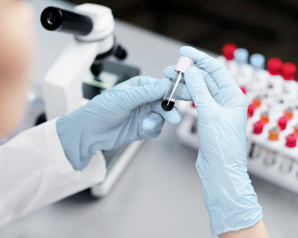 Syphilis Test & Example | Free PDF Download