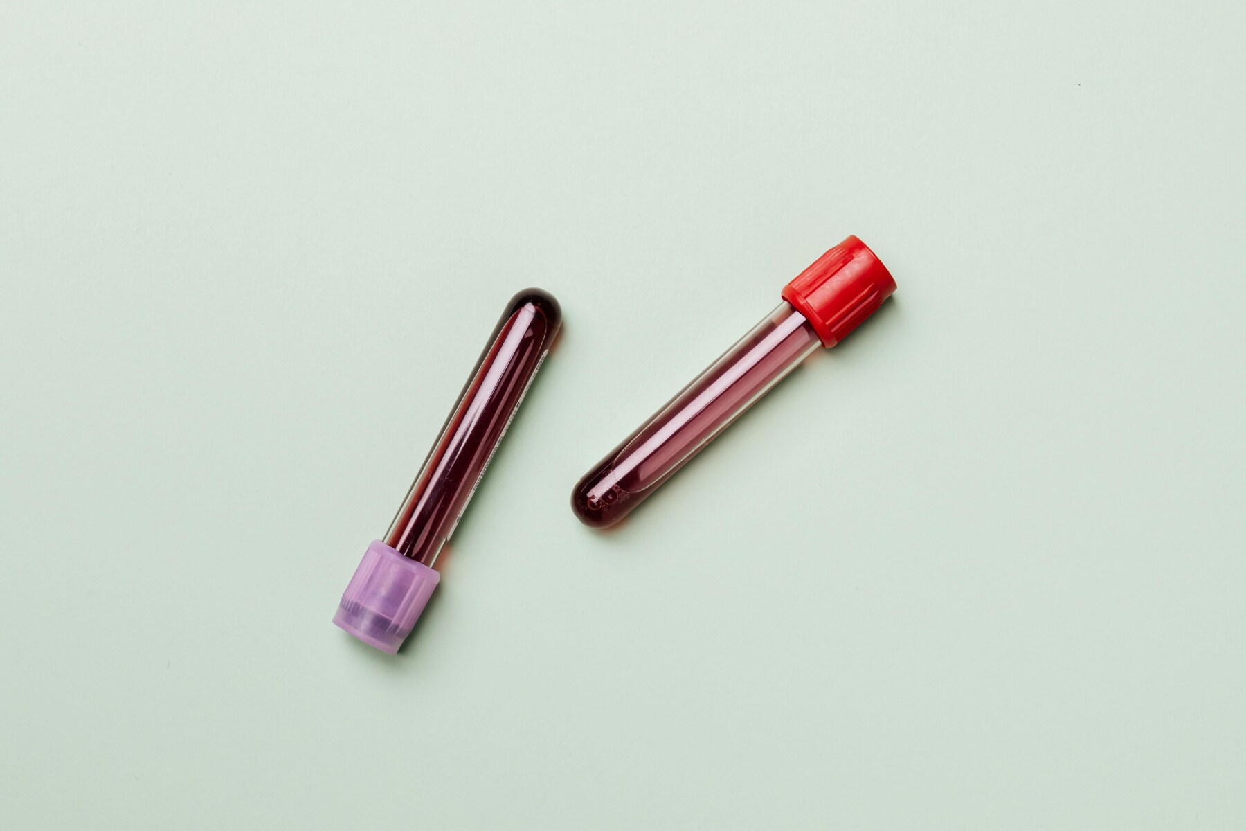 NIPT Blood Test & Example | Free PDF Download