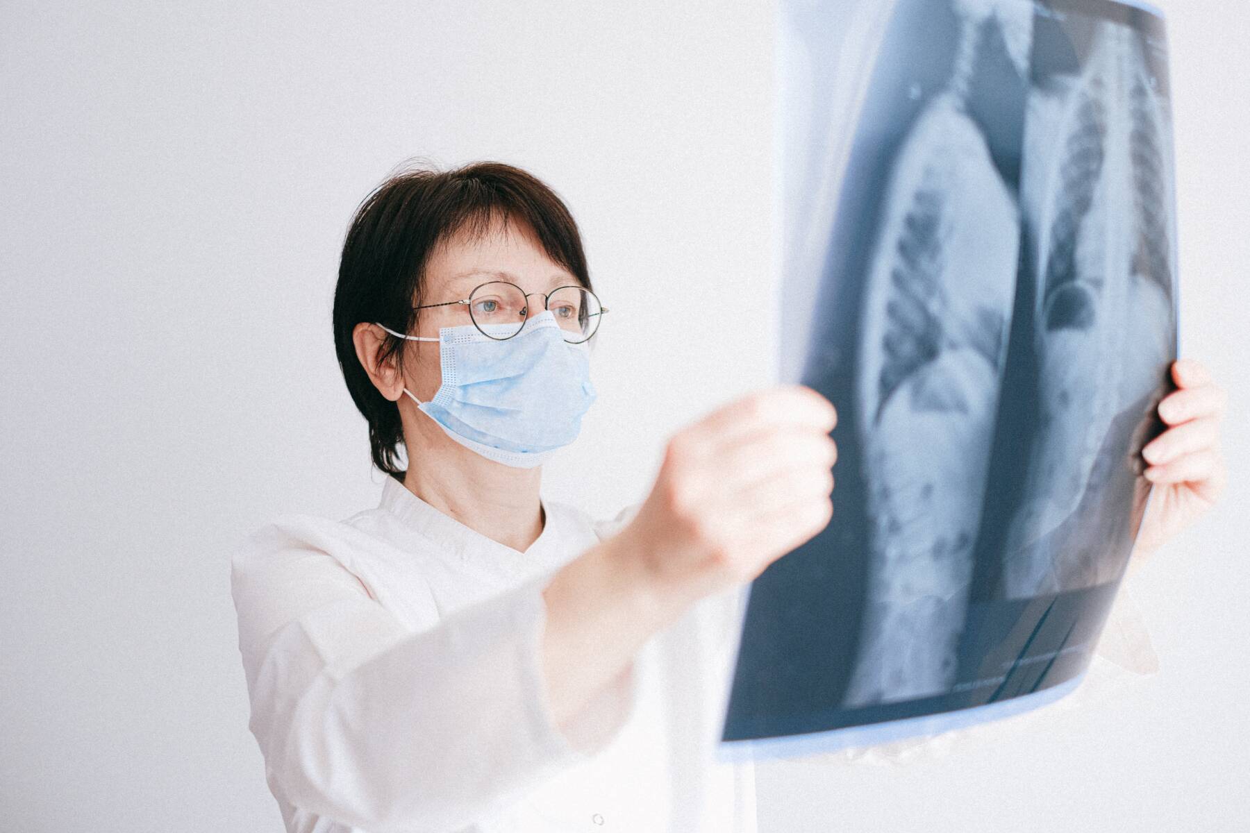 Pulmonary Embolism Nursing Care Plan Template & Example | Free PDF Download