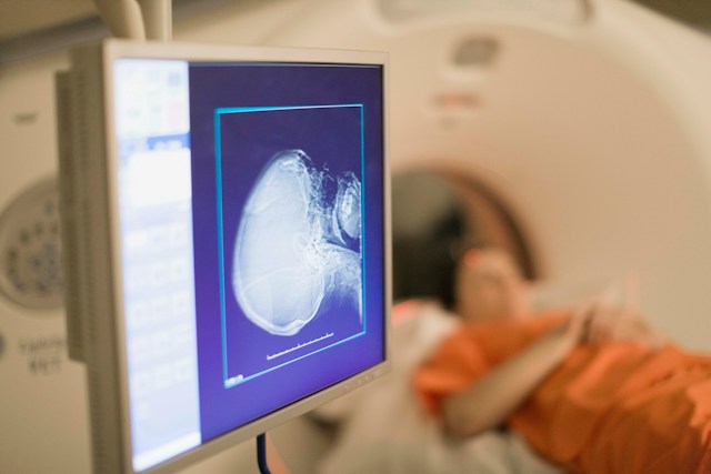 Cat Q Test & Example | Free PDF Download