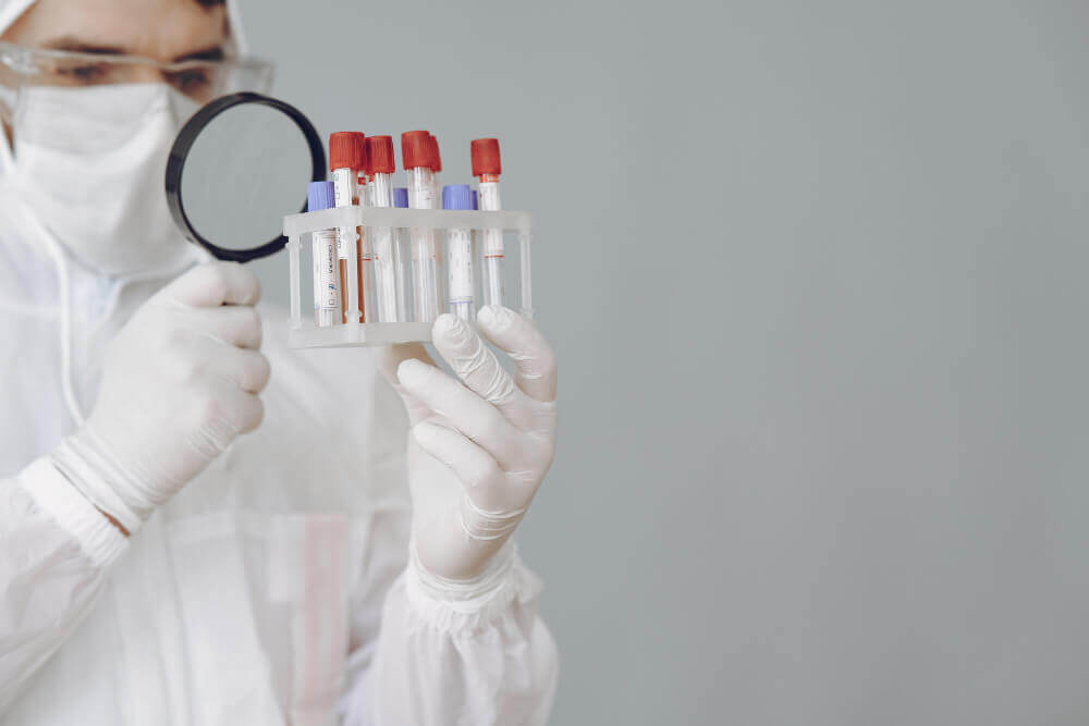 Hemoglobin A1C (HbA1c) Test & Example | Free PDF Download