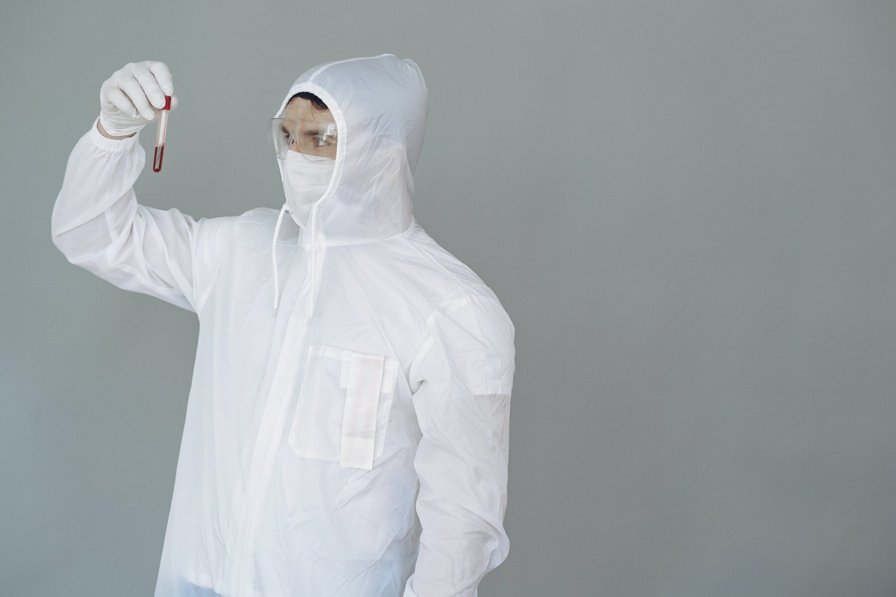 Immunofixation (IFE) Blood Test & Example | Free PDF Download