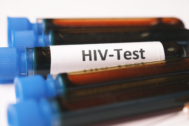 HIV Viral Load Chart & Example | Free PDF Download