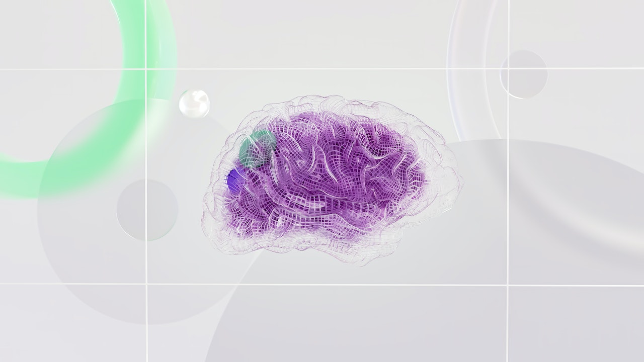 Brain Diagram & Example | Free PDF Download