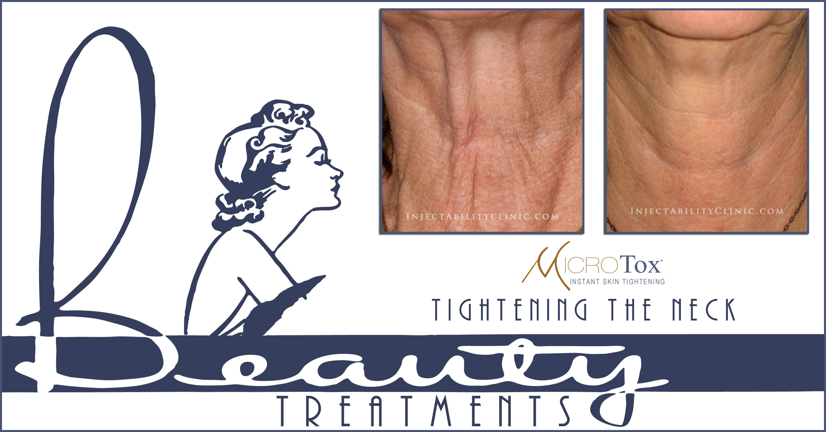 InjectAbility Clinic