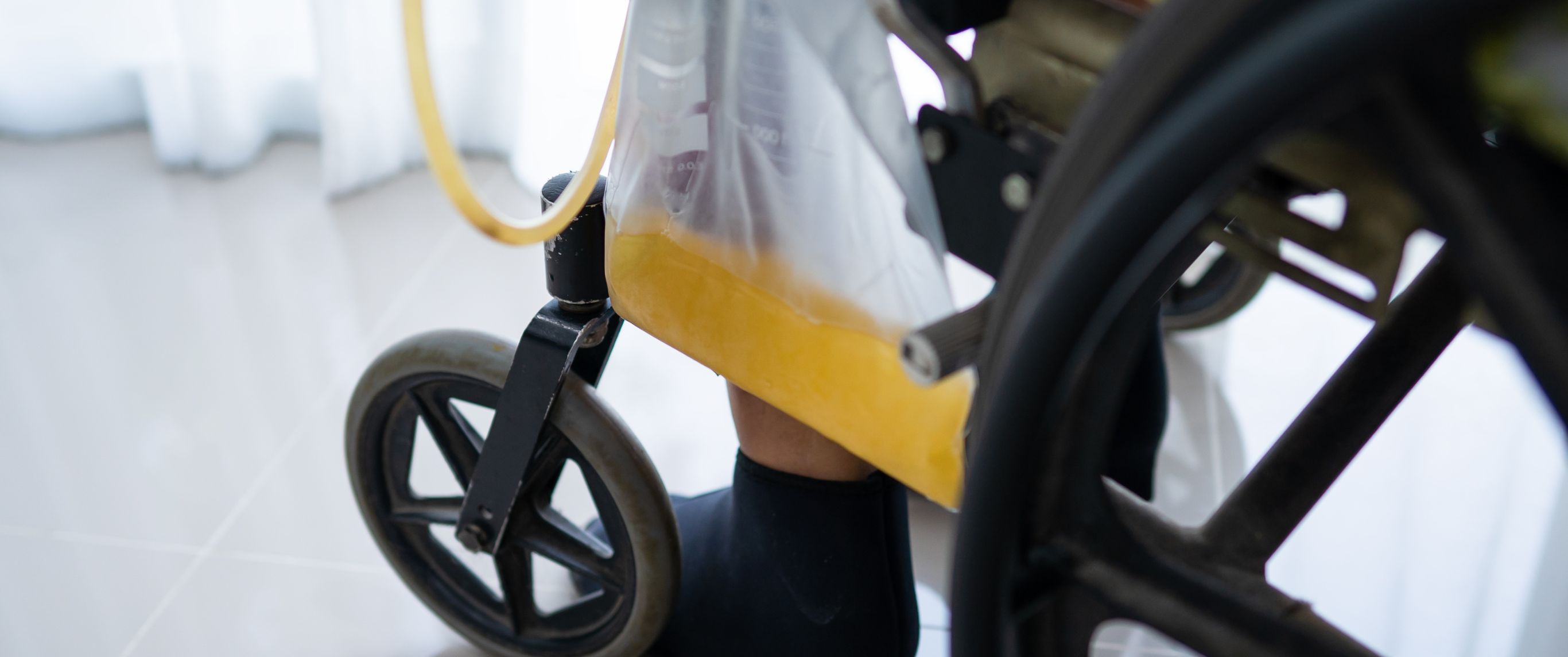Urinary Catheter Management - Health N Home - Home Care Brisbane
