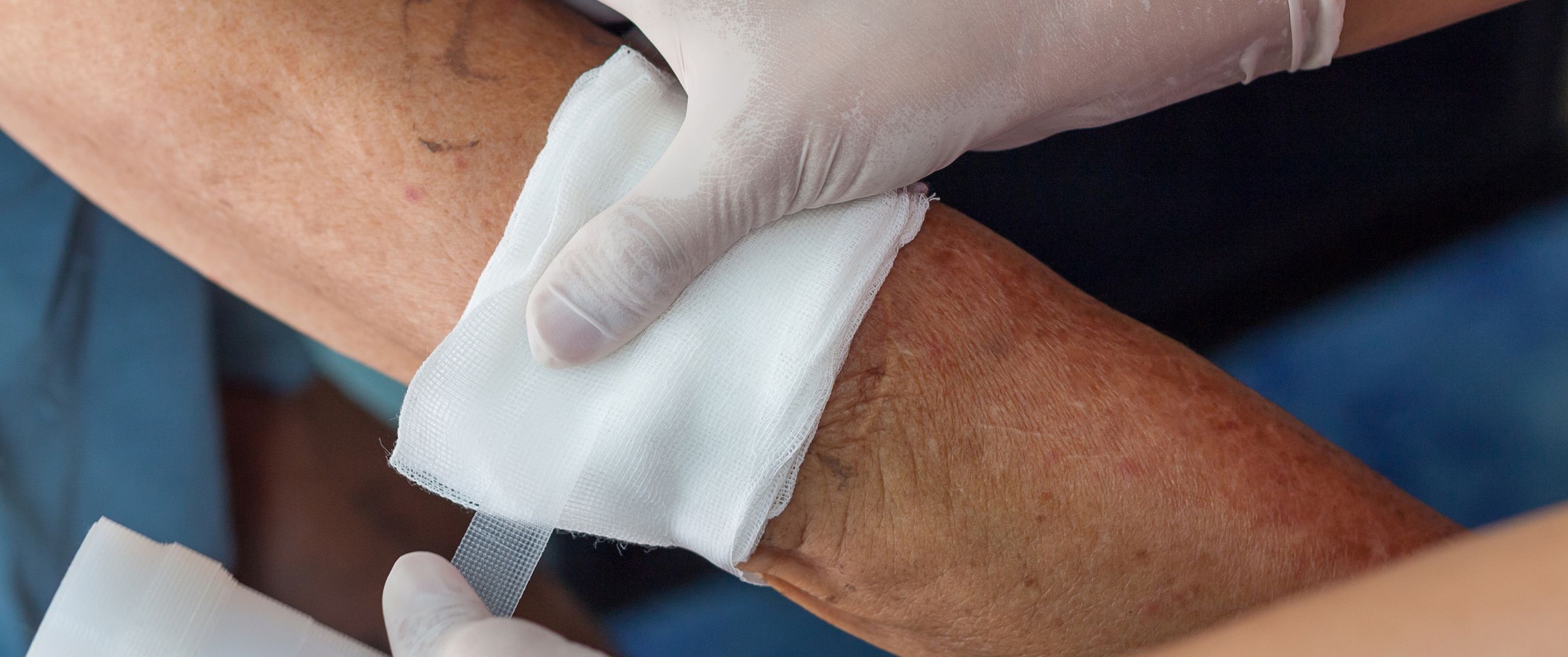Wound Care - Health N Home - Home Care Brisbane