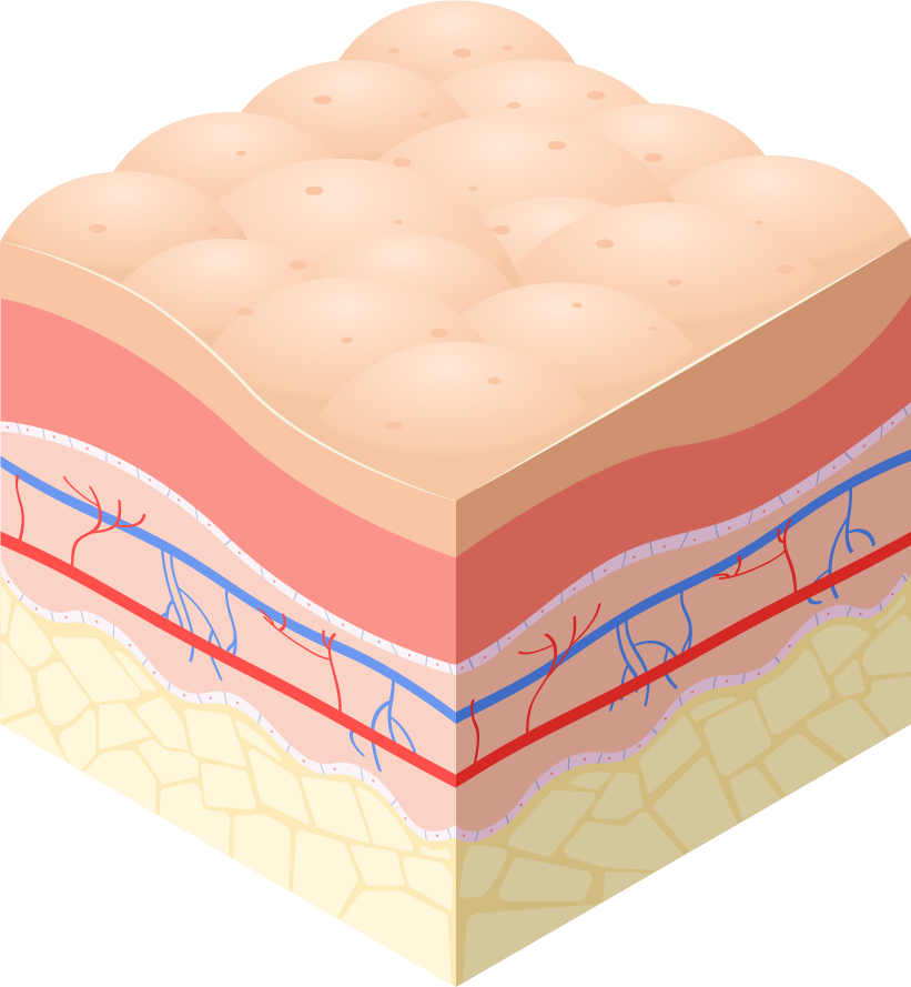 SLIMYONIK® Wissen – Cellulite