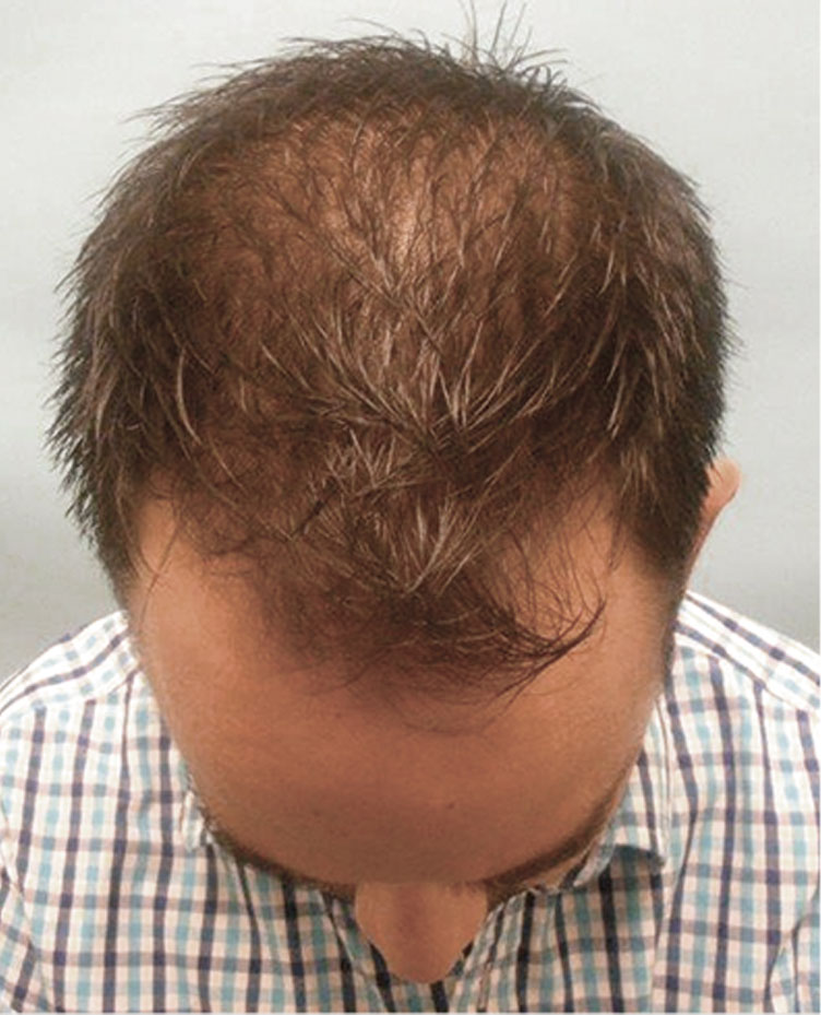 Locklab | 3-in-1 Hair Loss Treatment