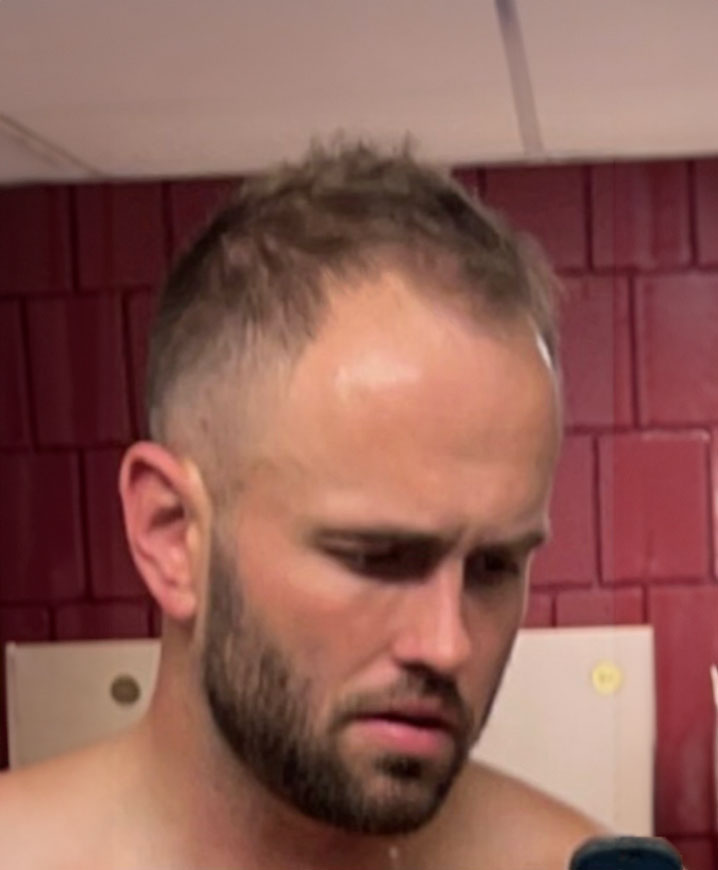 Locklab | 3-in-1 Hair Loss Treatment