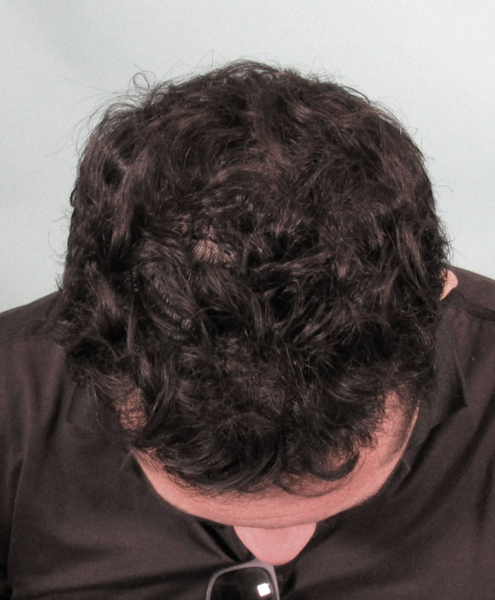 Locklab | 3-in-1 Hair Loss Treatment