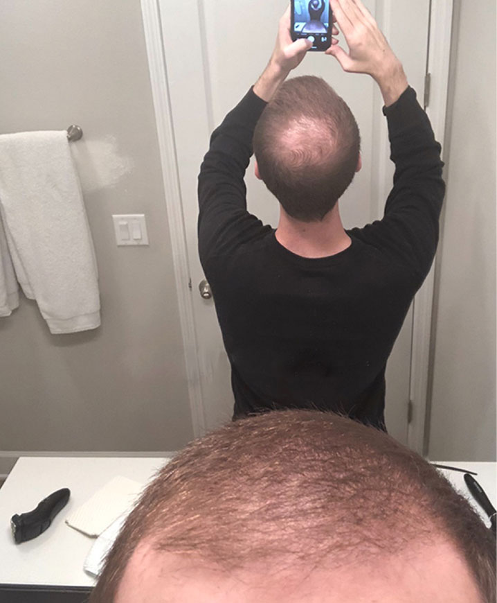 Locklab | 3-in-1 Hair Loss Treatment