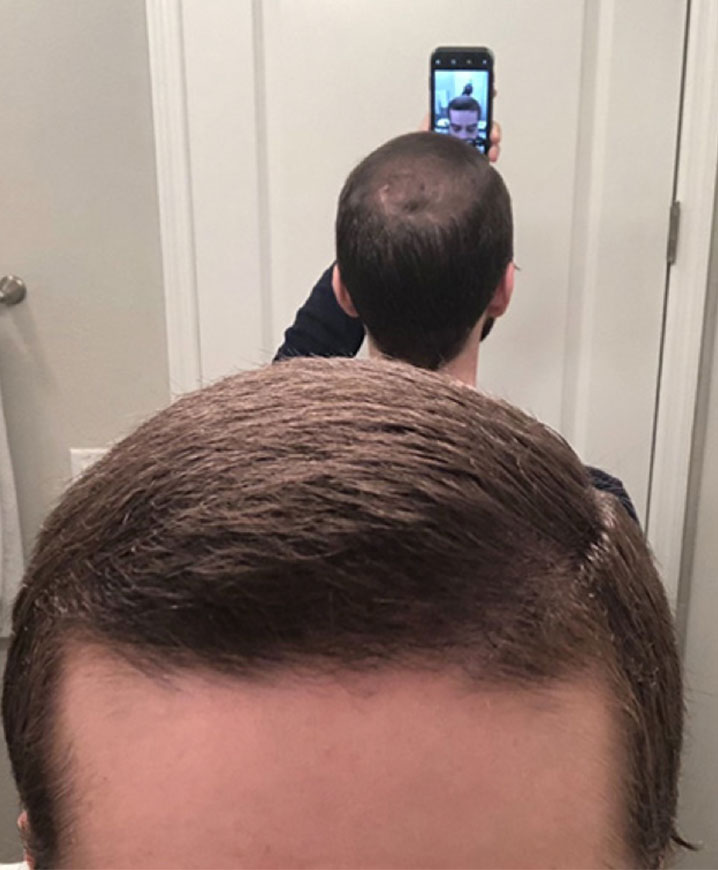 Locklab | 3-in-1 Hair Loss Treatment