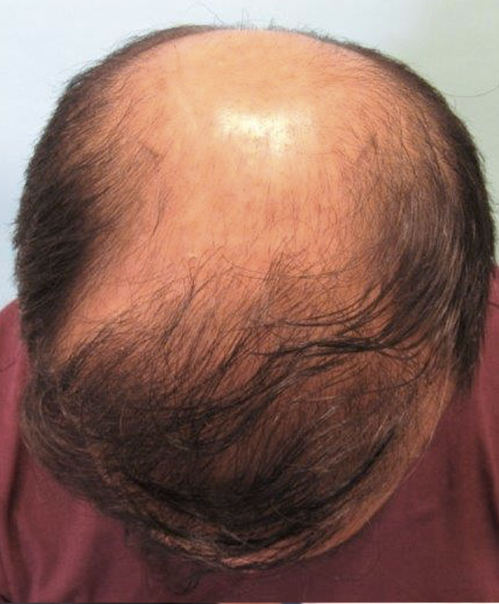 Locklab | 3-in-1 Hair Loss Treatment