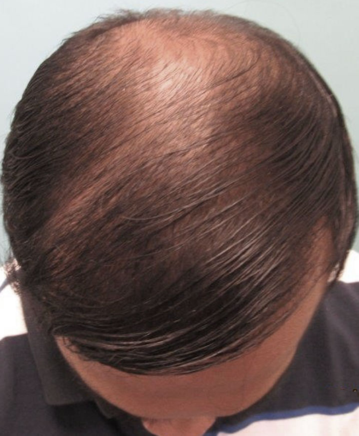 Locklab | 3-in-1 Hair Loss Treatment
