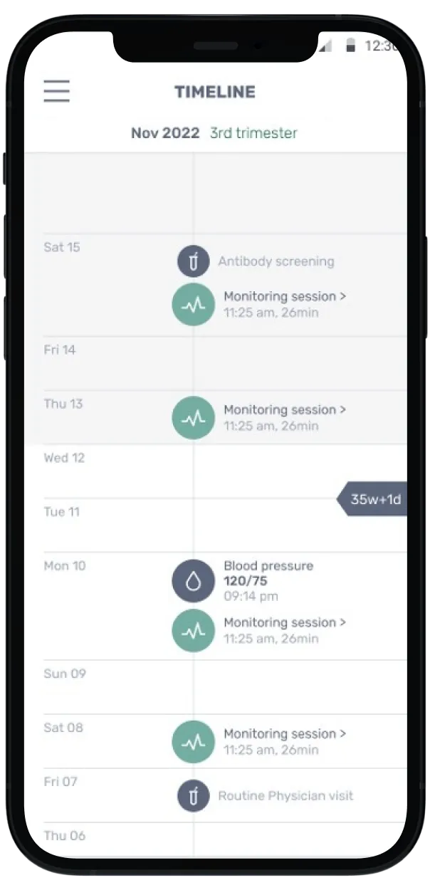 Nuvo Solutions - FDA-cleared remote fetal monitoring