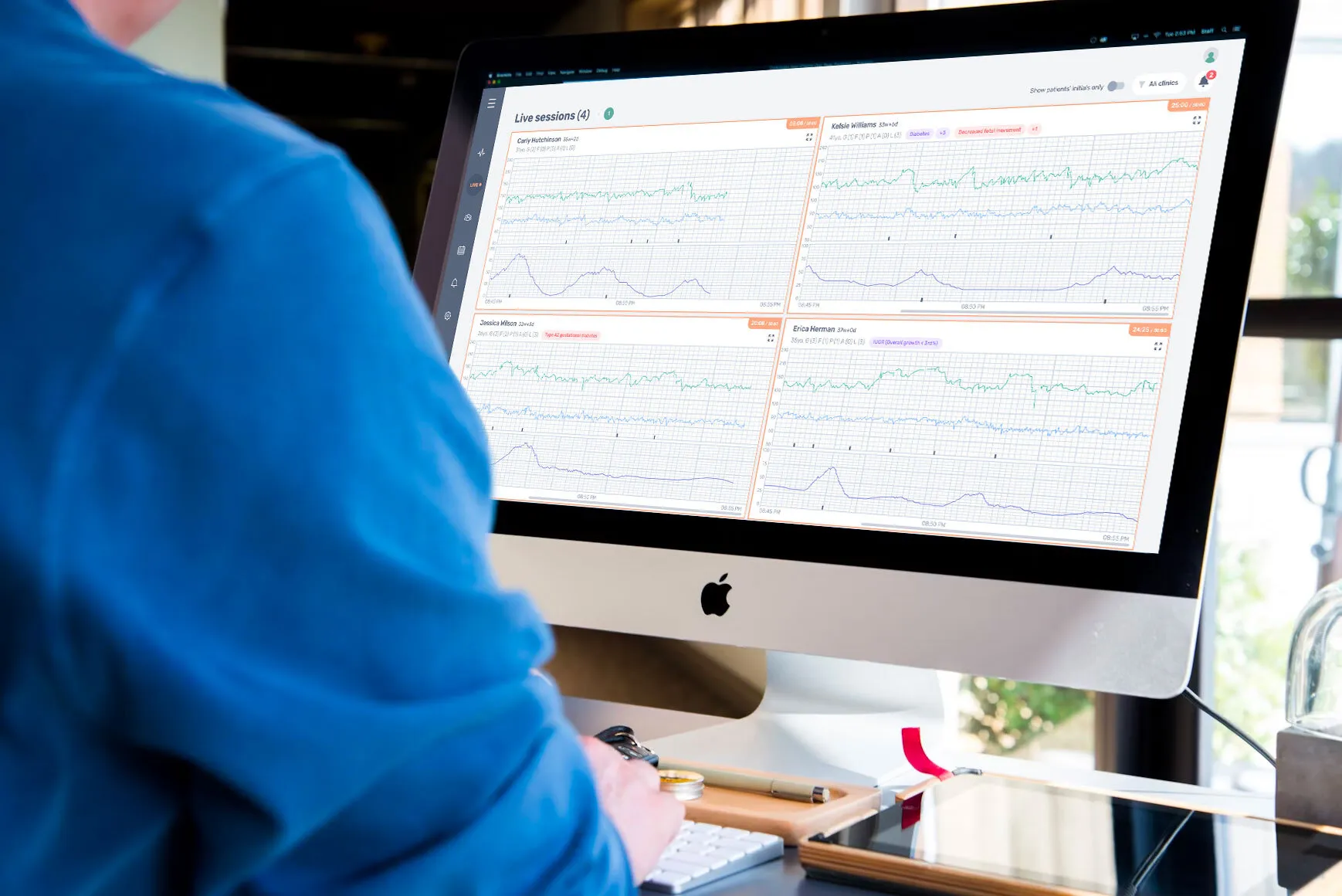 Nuvo Solutions - FDA-cleared remote fetal monitoring