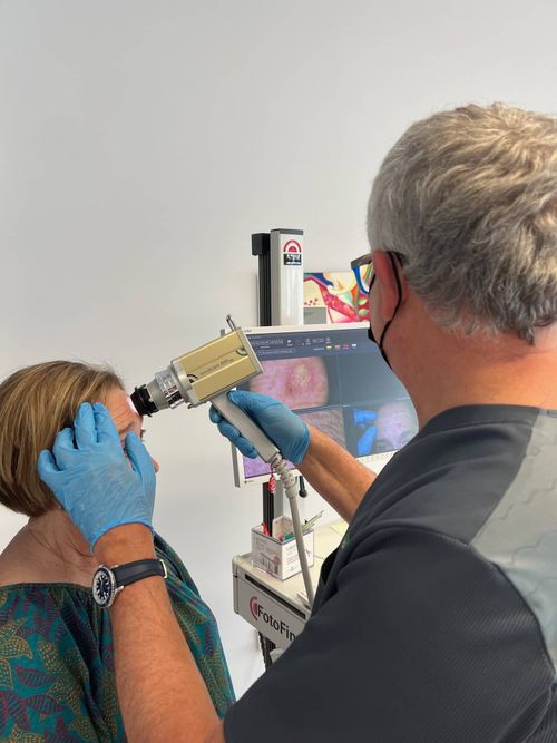 Fotofinder/trichoscan