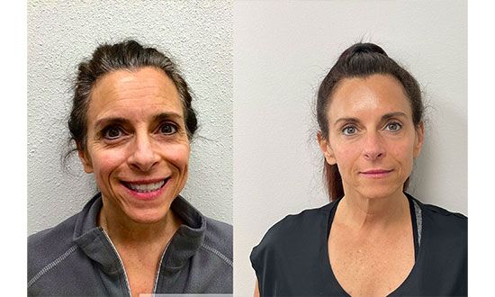 Laura Lewman, ND | Aesthetic Practitioner in Portland, OR